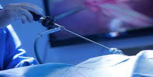 Gynecological Endoscopy - Sameda Clinics